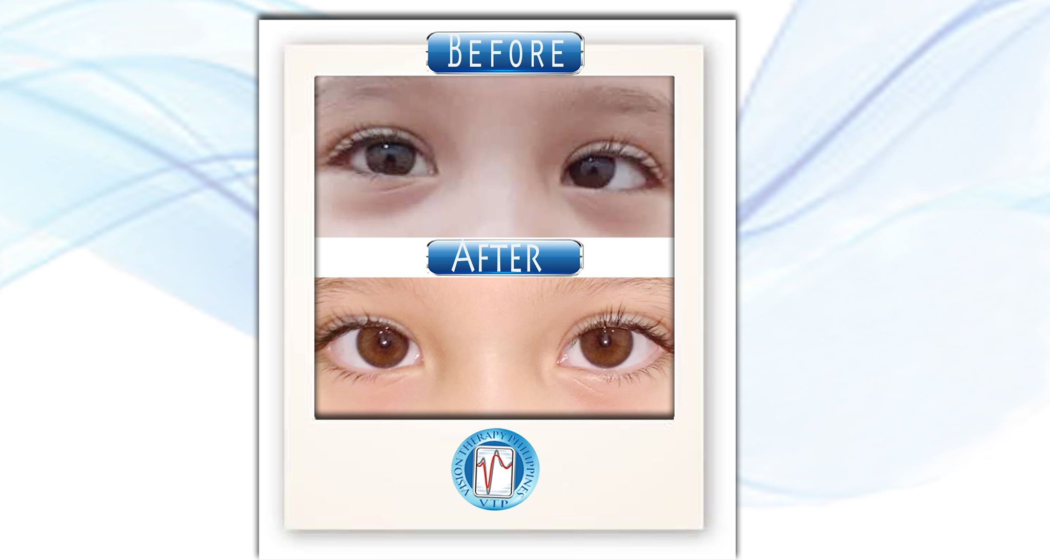 Gallery - Vision Therapy Philippines
